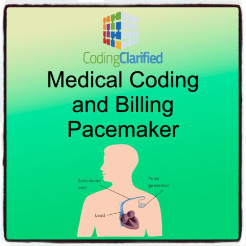 Medical Coding and Billing Pacemaker | Coding Clarified