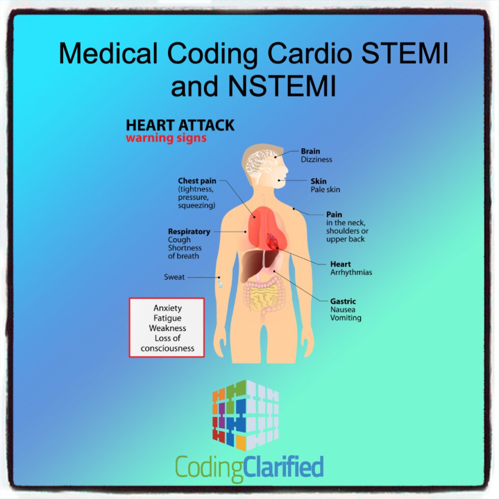 Medical Coding Cardio STEMI and NSTEMI | Coding Clarified