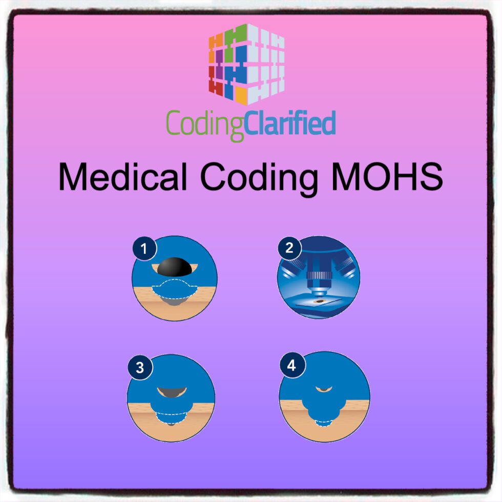 Medical Coding MOHS | Coding Clarified