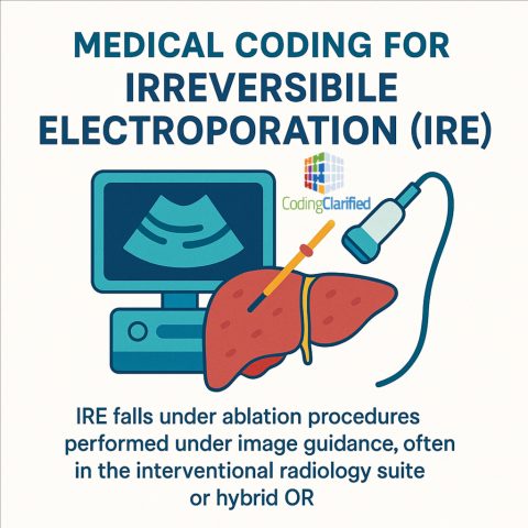 Medical Coding for Irreversible Electroporation (IRE) | Coding Clarified